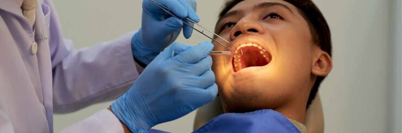 Surgical Tooth Extraction Clinic in Newtown | Book Appointment!!